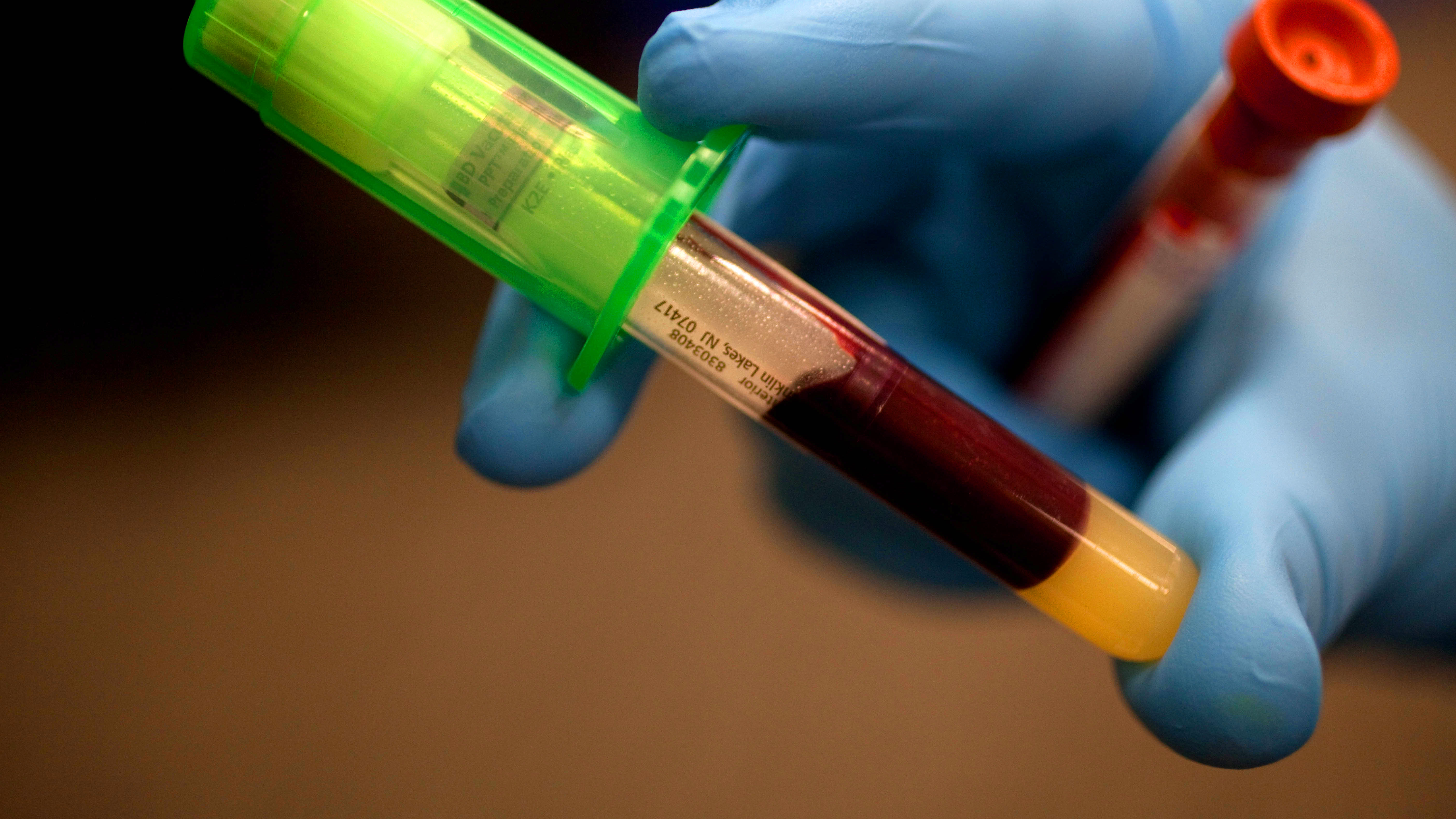 Un nou test de sânge ar putea detecta opt tipuri de cancer